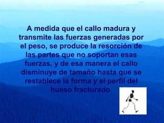 3. callo oseos i | PPT