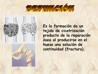 3. callo oseos i | PPT