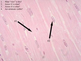 Cardiac Muscle Slides