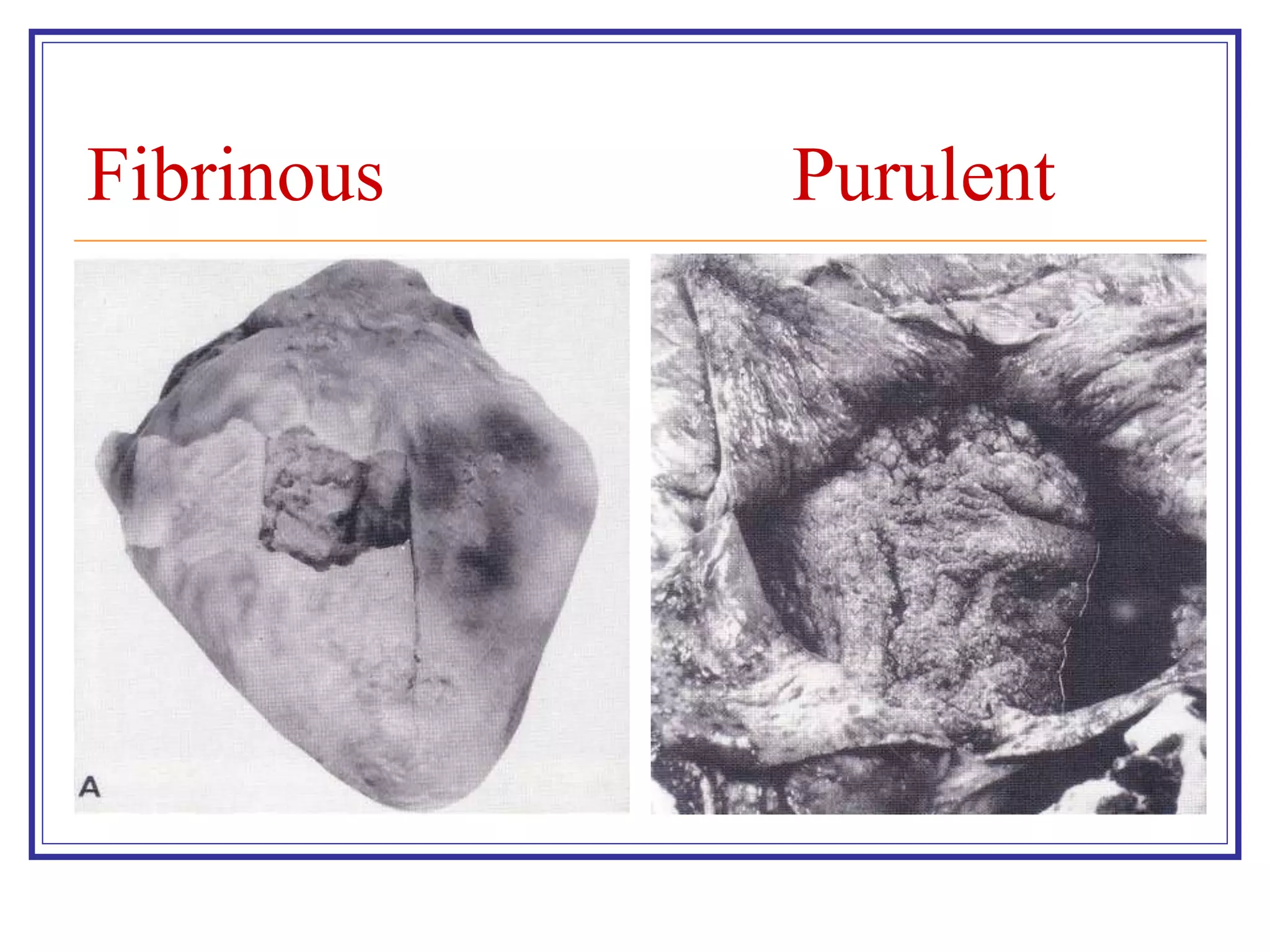 Veterinary Pathology of cardiovascular system | PPT