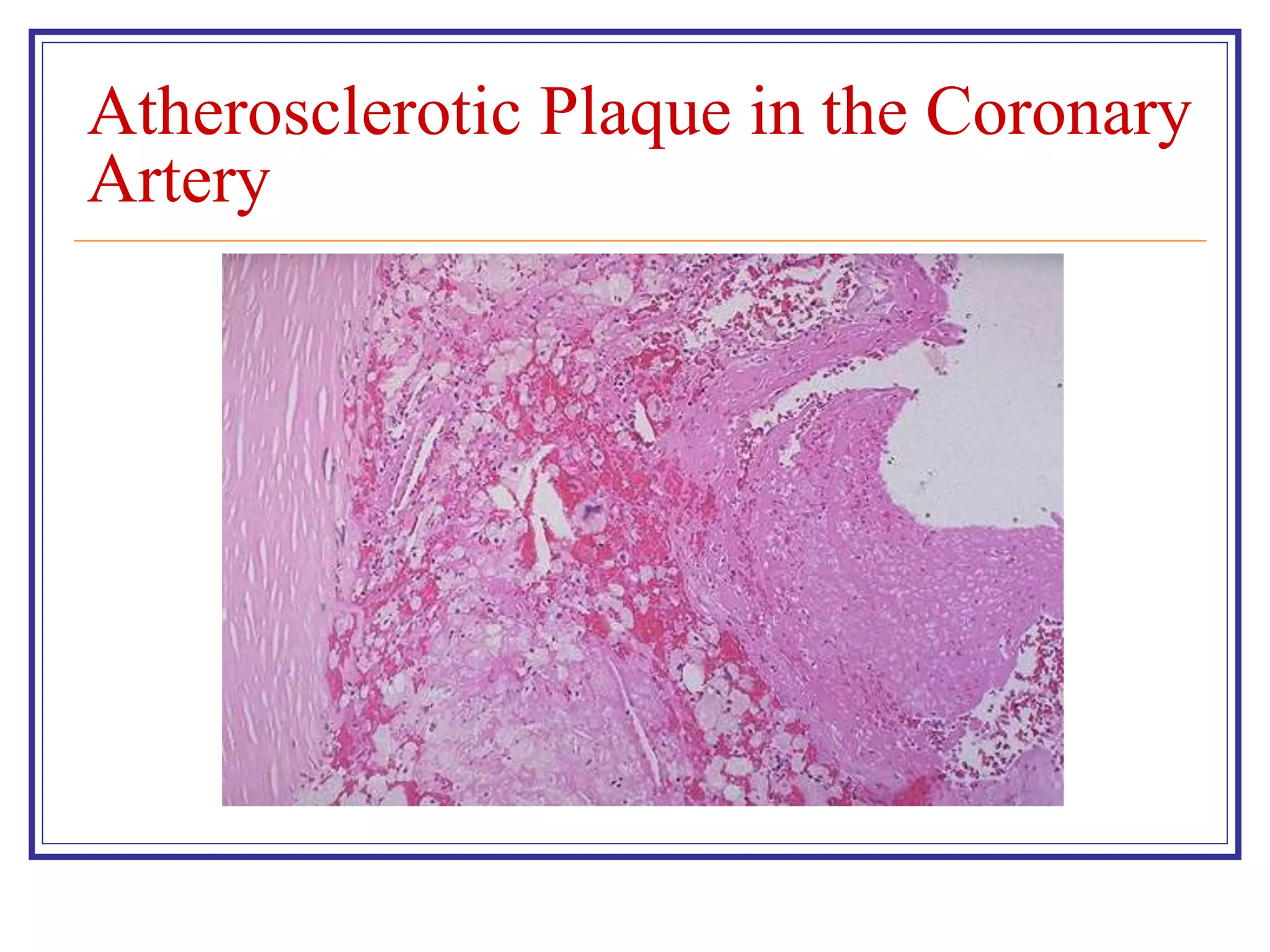 Veterinary Pathology of cardiovascular system | PPT
