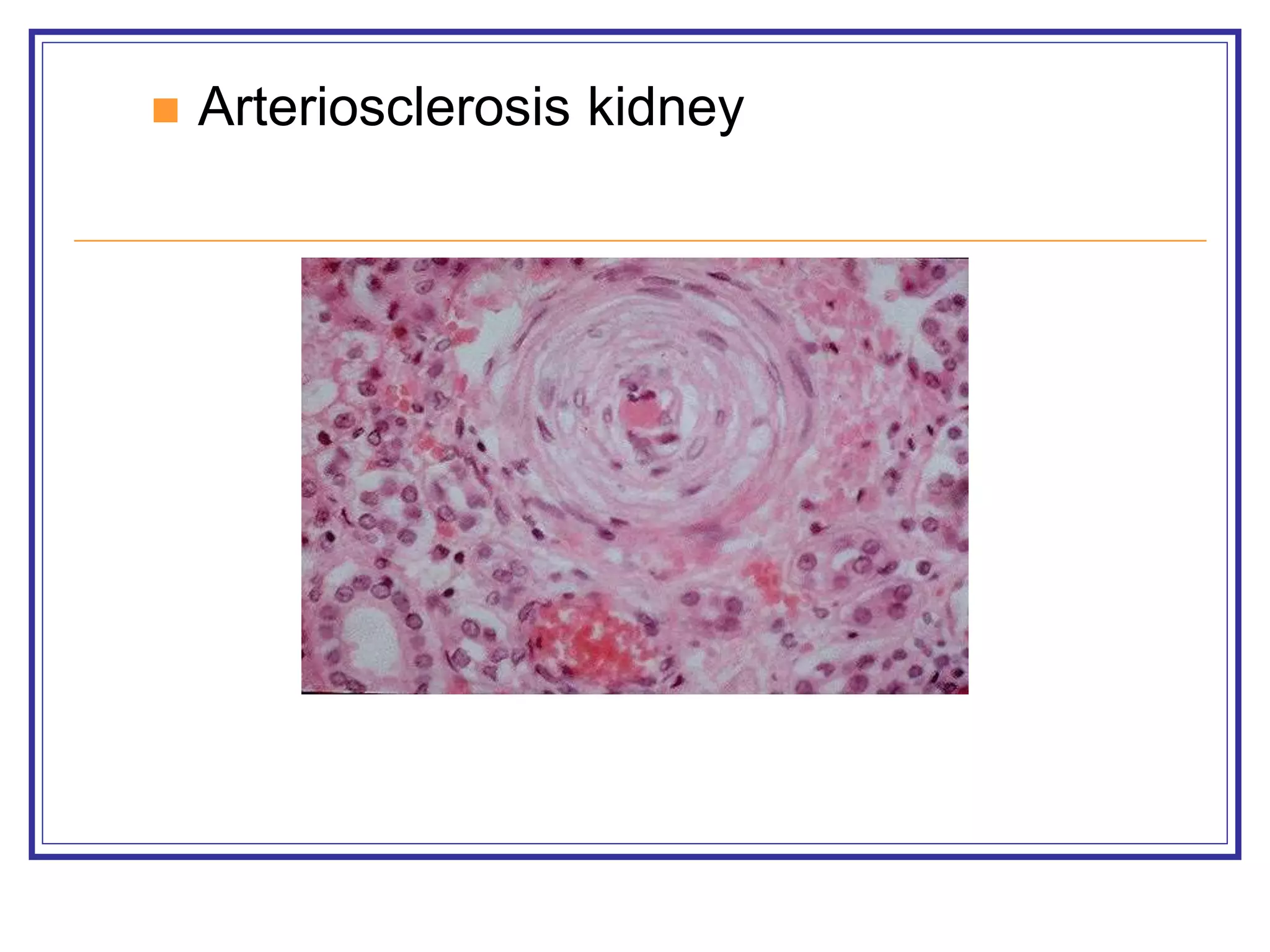 Veterinary Pathology of cardiovascular system | PPT