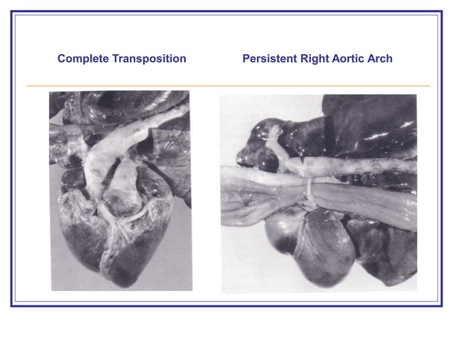 Veterinary Pathology of cardiovascular system | PPT | Heart and ...