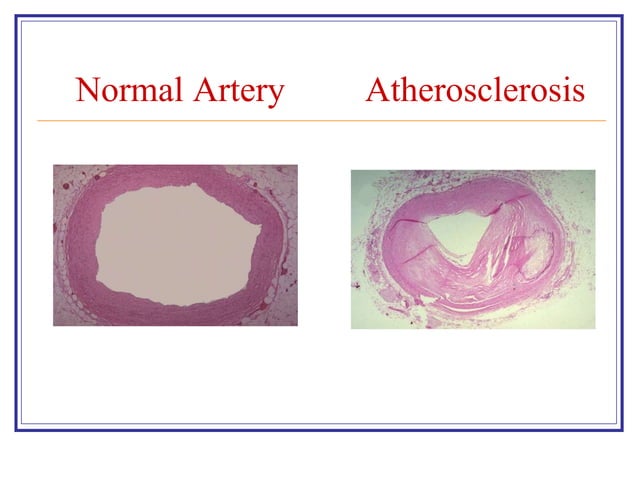 Veterinary Pathology of cardiovascular system | PPT | Heart and ...