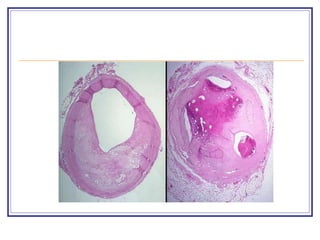 Veterinary Pathology of cardiovascular system | PPT