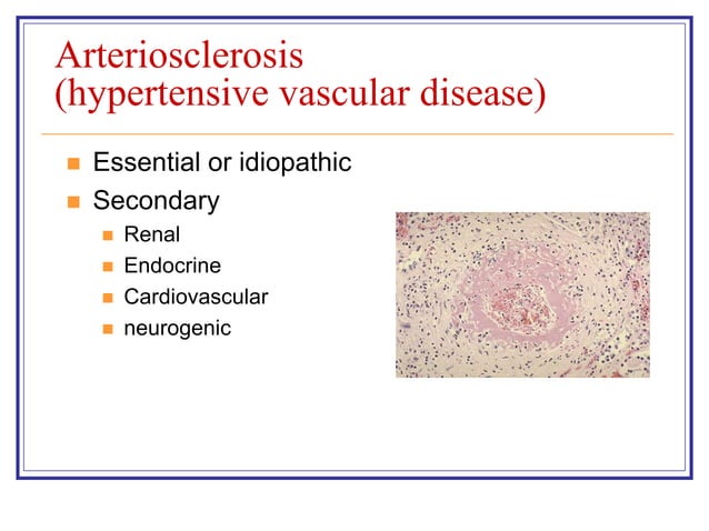 Veterinary Pathology of cardiovascular system | PPT | Heart and ...