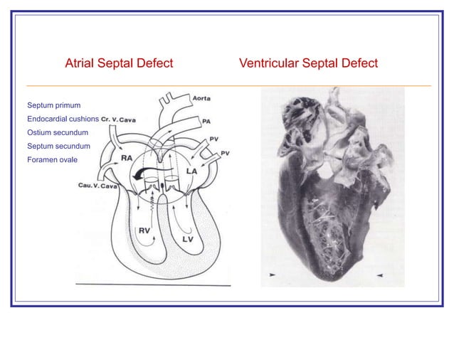 Veterinary Pathology of cardiovascular system | PPT | Heart and ...