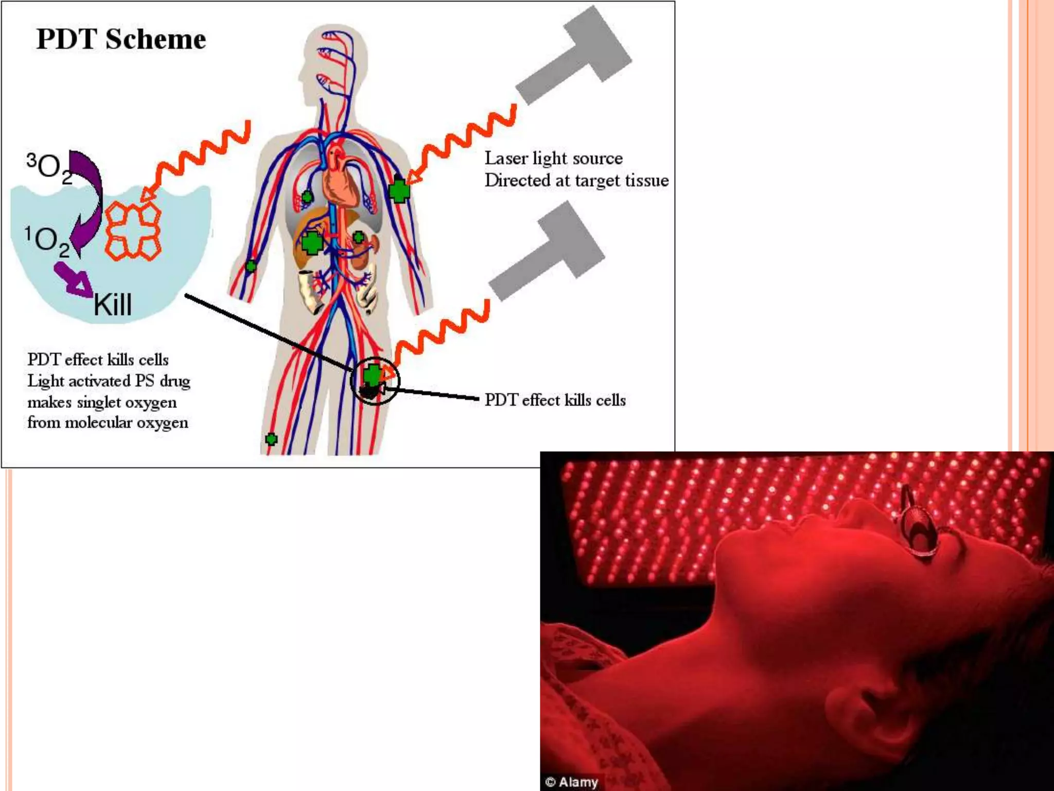 3. Cellular Aberration | PPTX