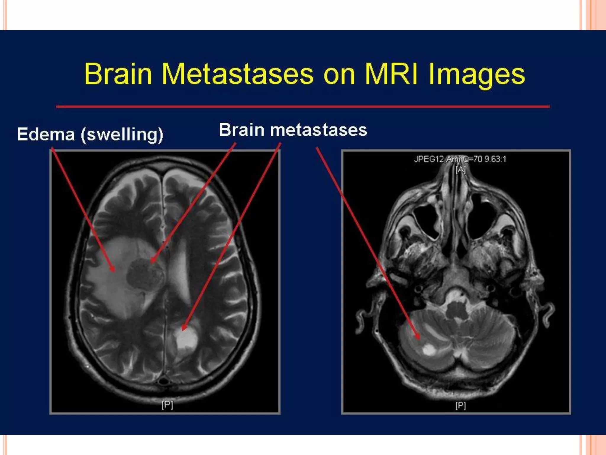 3. Cellular Aberration | PPTX