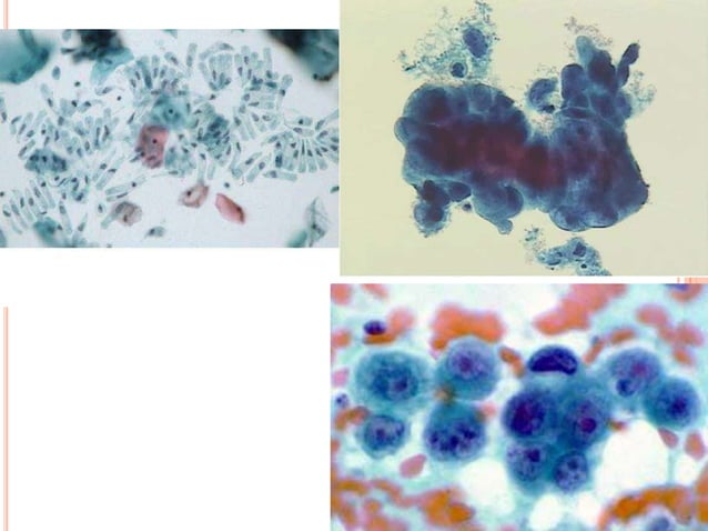 3. Cellular Aberration | PPTX