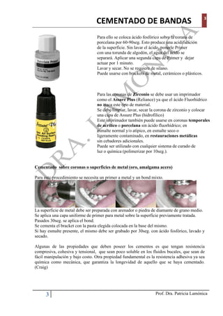 Cementado de Bandas | PDF