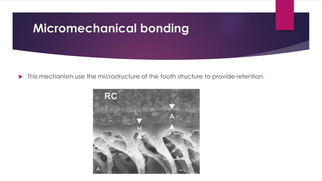 cementation in Fixed prosthodontics | PPTX