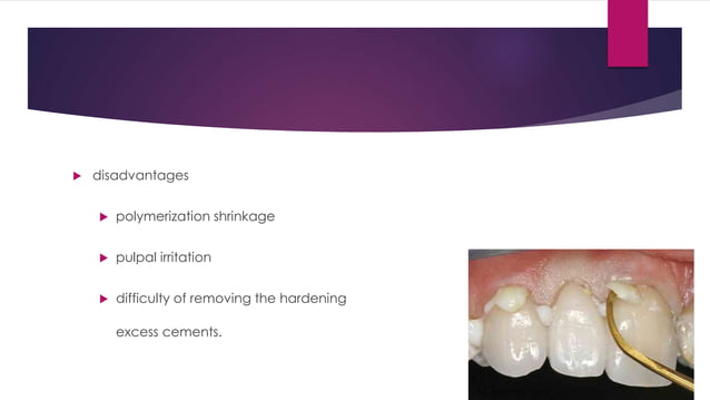 cementation in Fixed prosthodontics | PPTX
