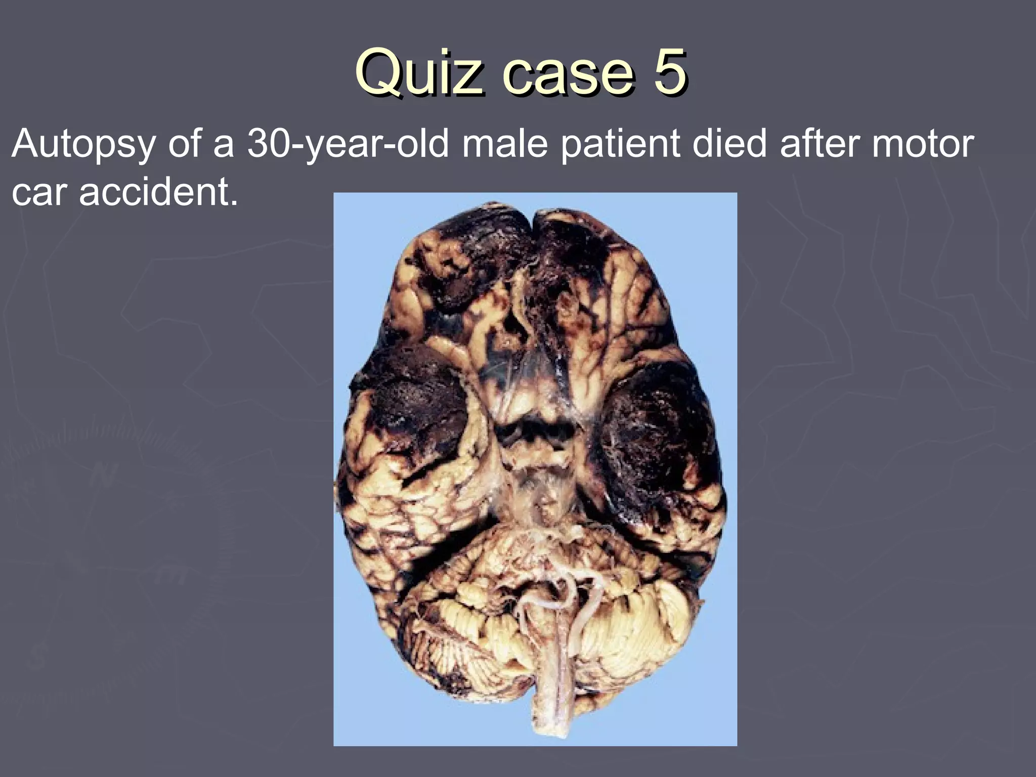 3- Chest emergency-trauma | PPT