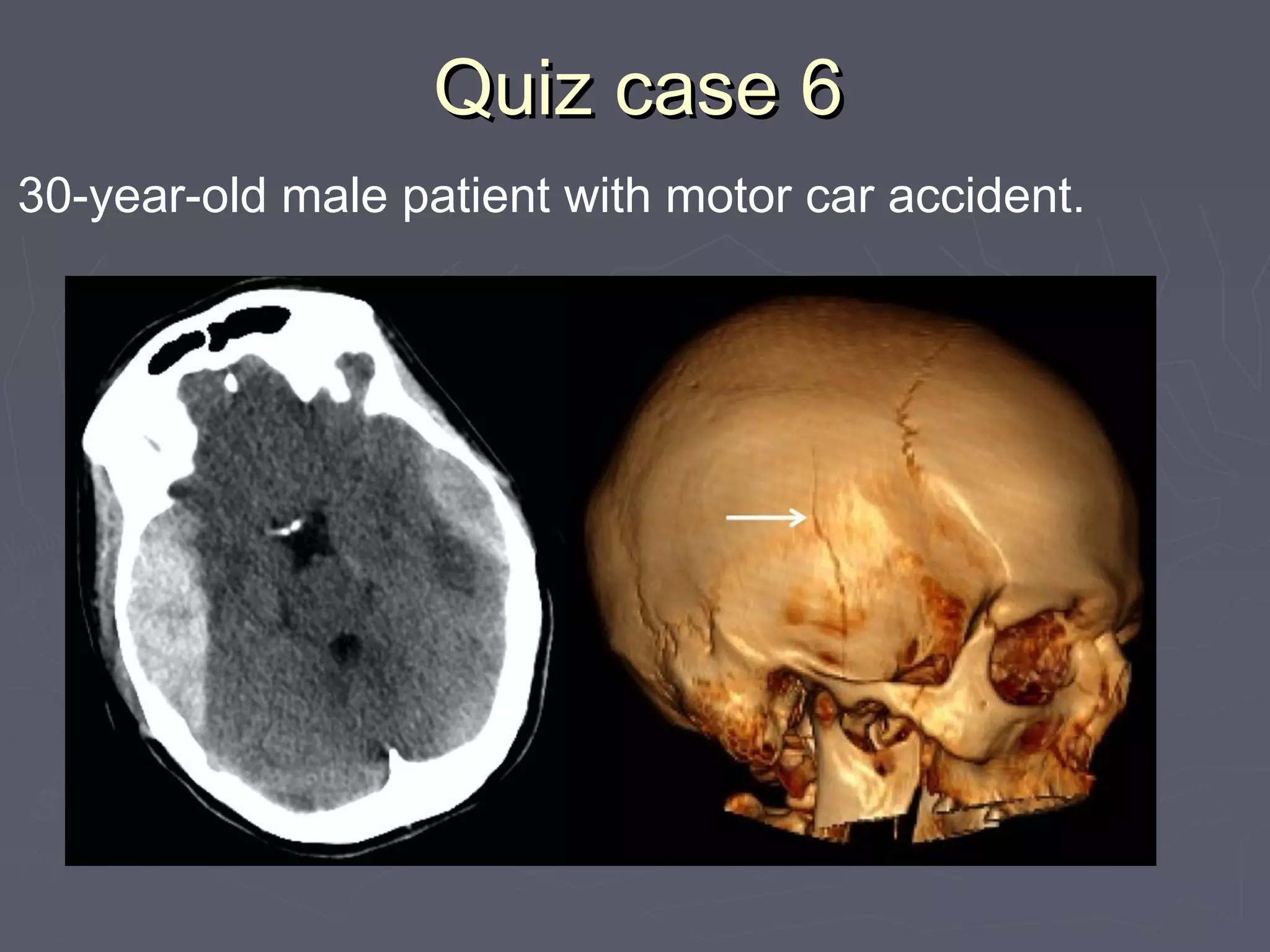 3- Chest emergency-trauma | PPT