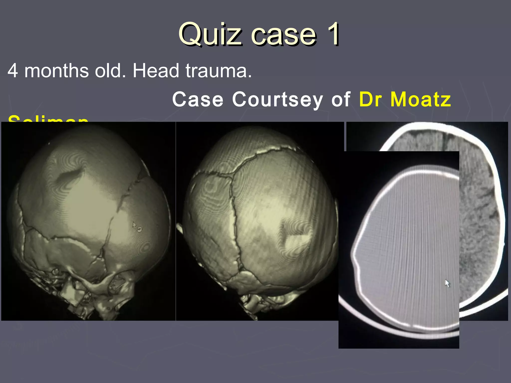 3- Chest emergency-trauma | PPT