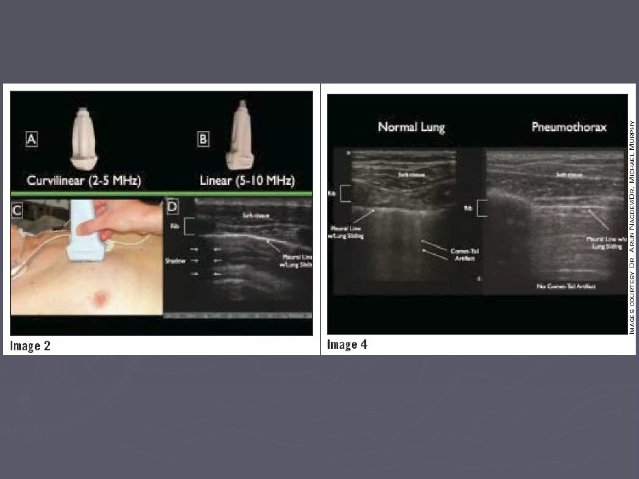 3- Chest emergency-trauma | PPT