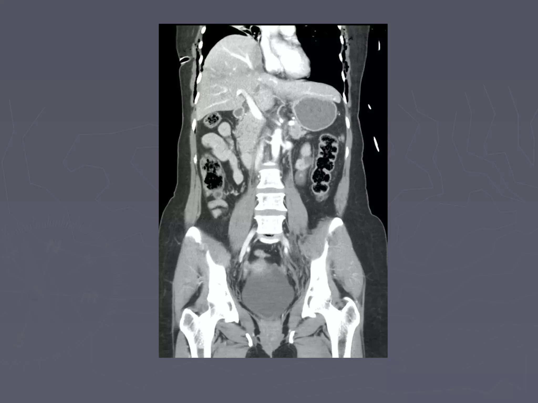 3- Chest emergency-trauma | PPT