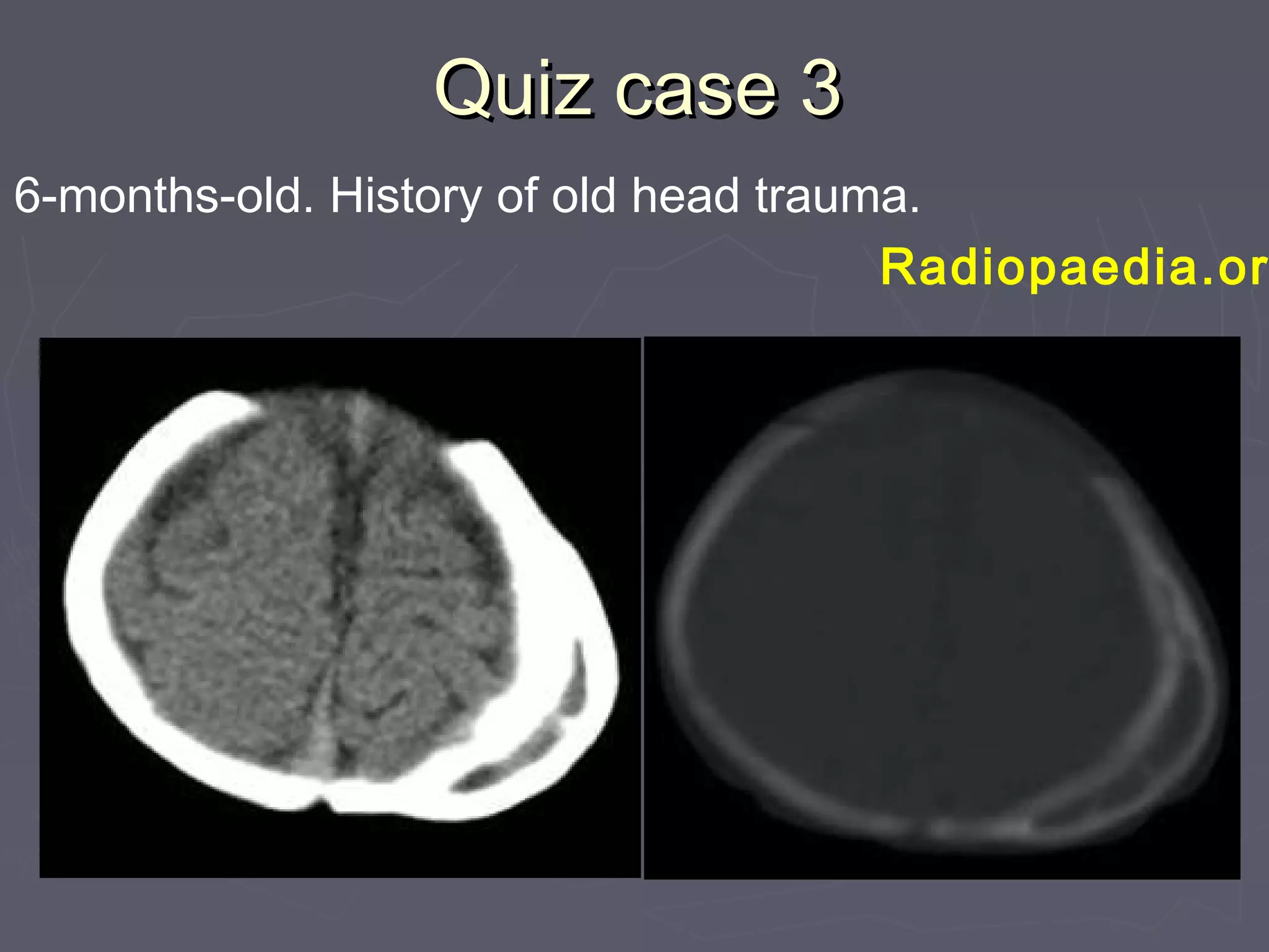 3- Chest emergency-trauma | PPT