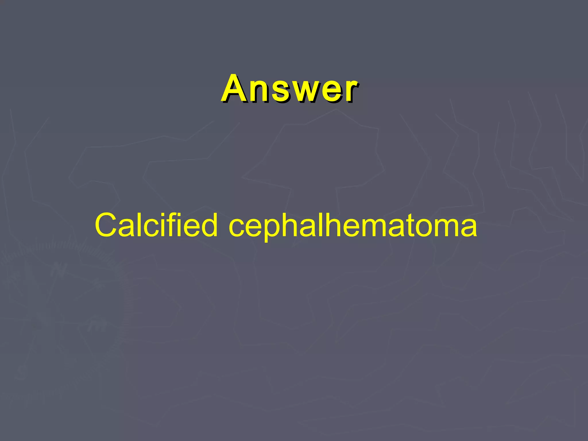 3- Chest emergency-trauma | PPT