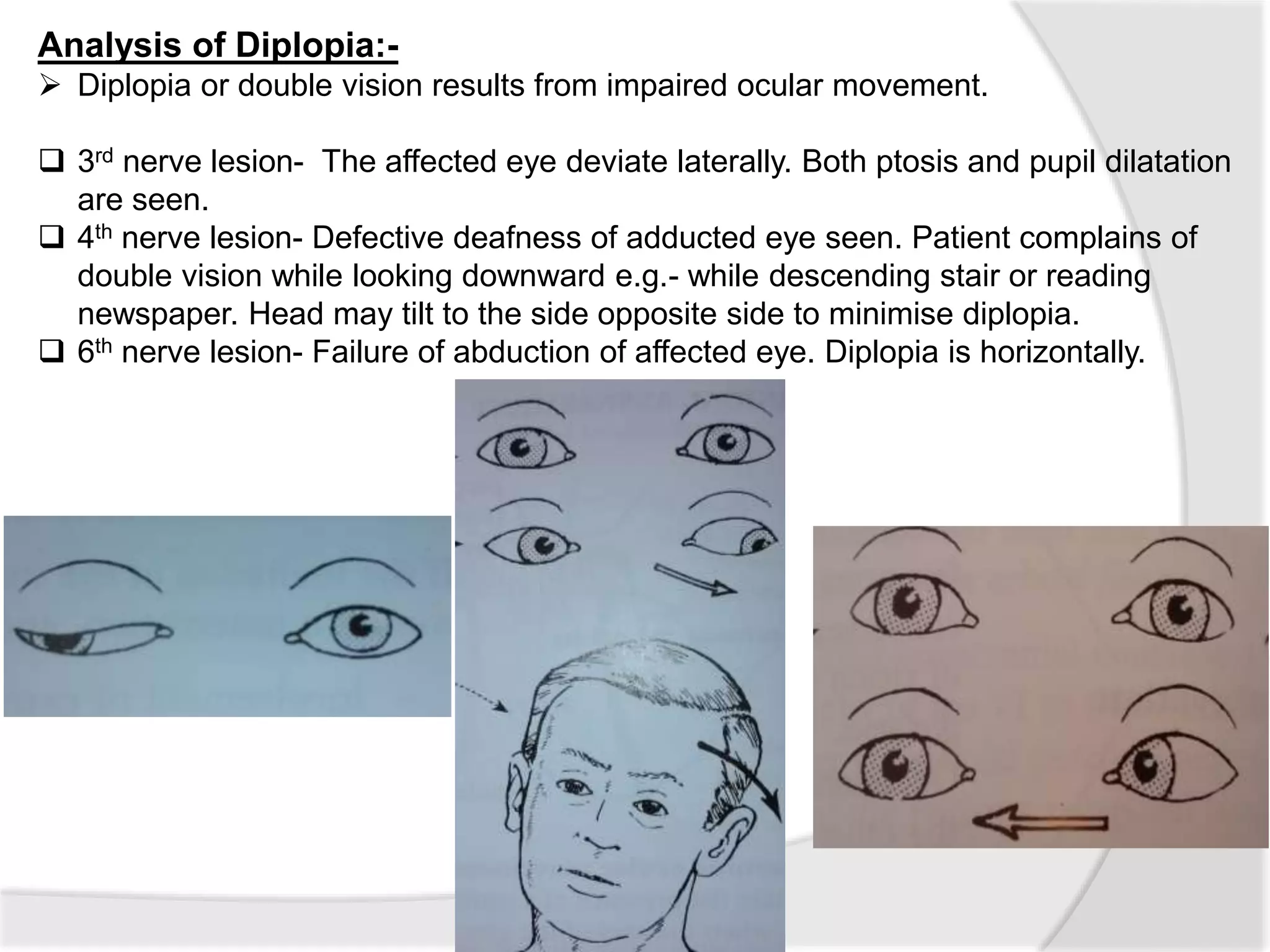 Part 3 cranial nerve examination | PPTX