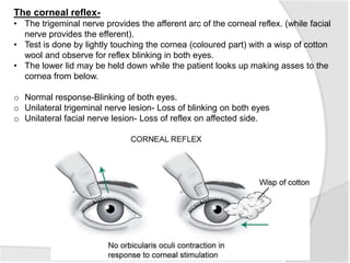 Part 3 cranial nerve examination | PPTX