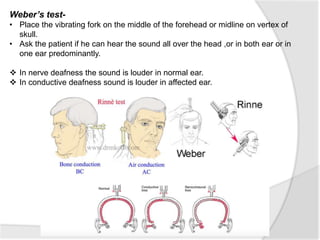 Part 3 cranial nerve examination | PPTX