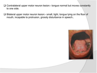 Part 3 cranial nerve examination | PPTX