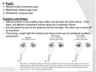 Part 3 cranial nerve examination | PPTX