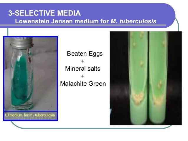 Mycobacterium Tuberculosis Culture Media