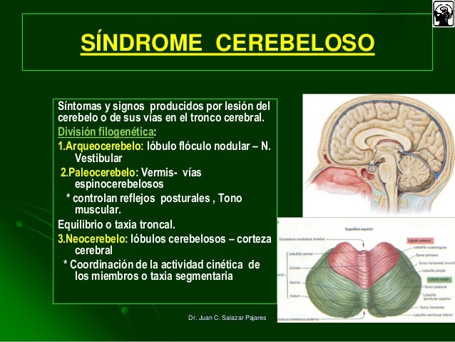 SINDROMES NEUROLOGICOS III - Cerebeloso, Demencial, Miopático, Hipert…