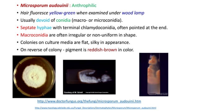 Dermatophytes:Microsporum, Trichophytom, Epidermophyton | PDF | Skin ...
