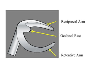 3 +++direct+retainers | PPT
