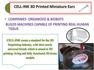 3 d printed prosthetics | PPTX