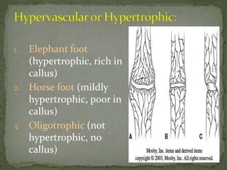 Delayed Union and non union fractures | PPTX