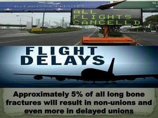 Delayed Union and non union fractures | PPTX
