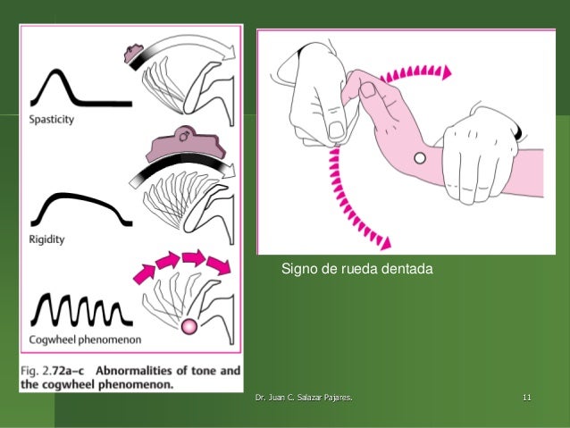 3 e-grandes-s -ndromes_iv-extrapiramidal-2016_1_