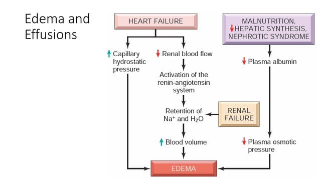 Hemodynamic disorders - Edema, Hyperemia, Hemorrahge by DR. ROOPAM JAIN ...