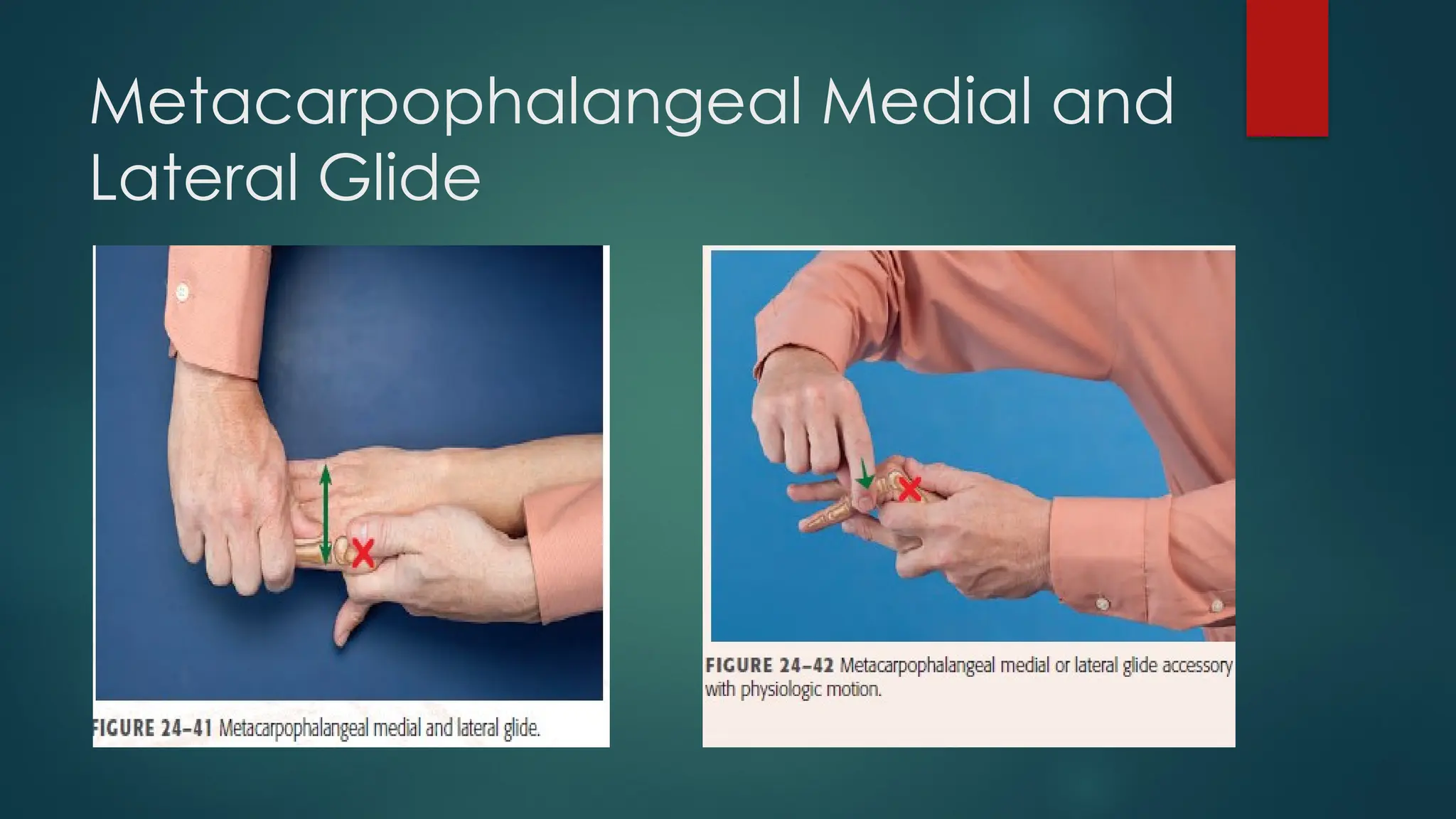 3- elbow & hand mobilization.and muscles and bone | PPTX