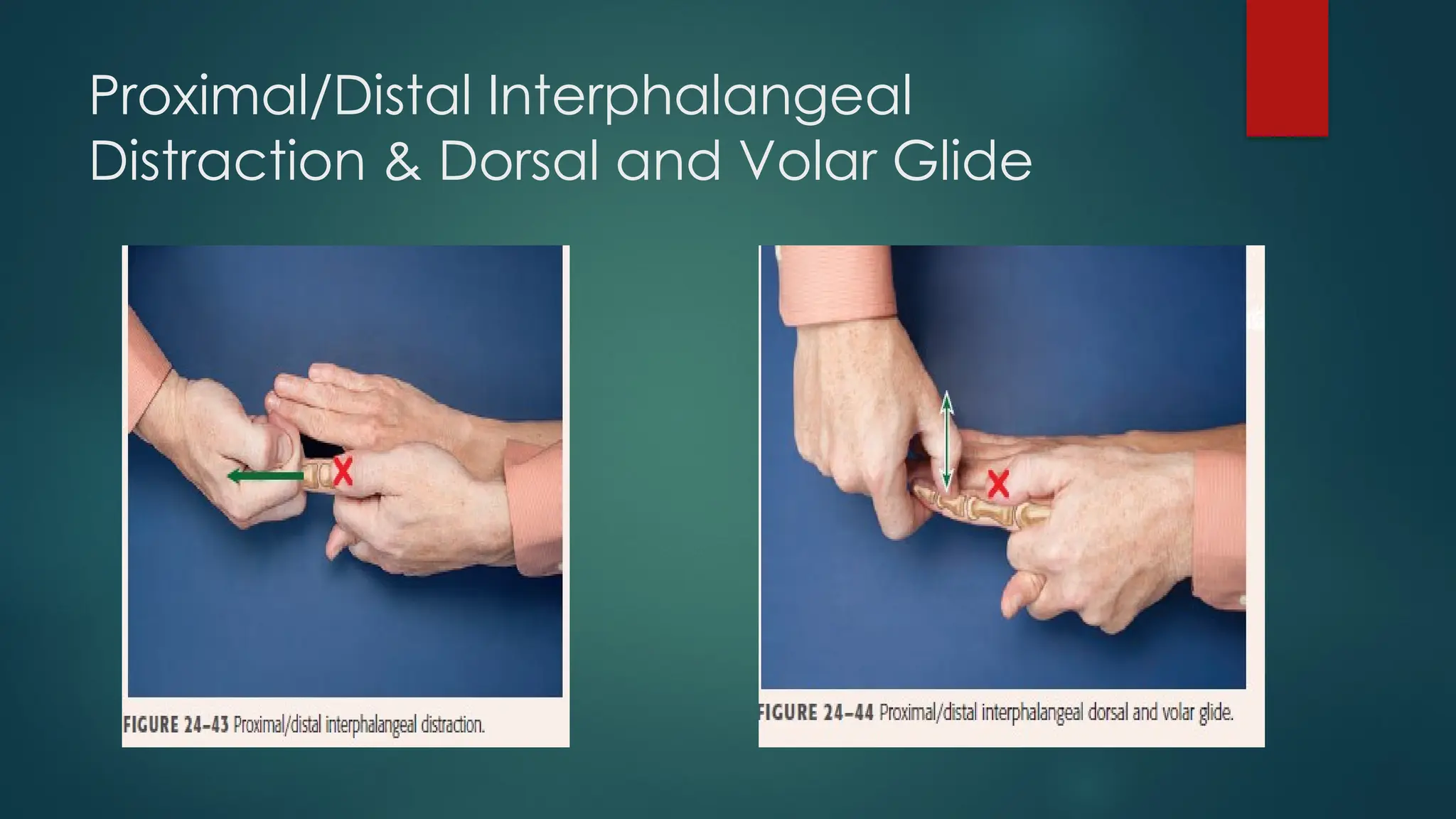 3- elbow & hand mobilization.and muscles and bone | PPTX