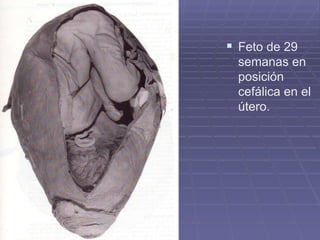 3. embriologia de-la_novena_a_la_trigesimo_octava_semanas | PPT