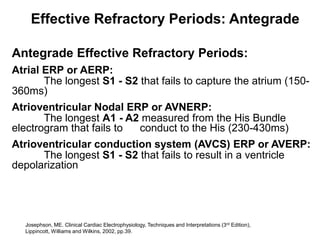 Electrophysiologic Study | PDF