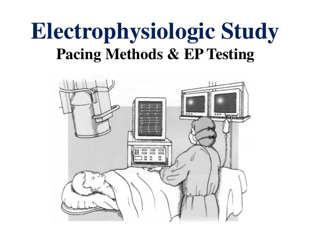 Electrophysiologic Study