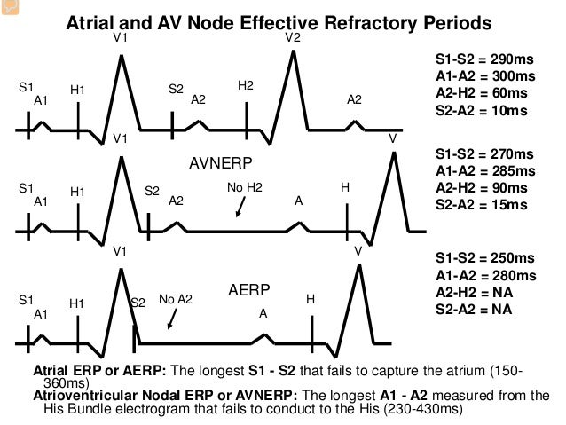 Electrophysiologic Study