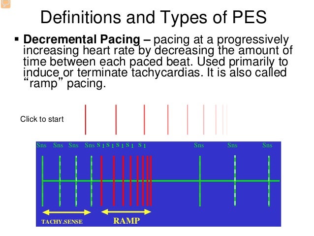 Electrophysiologic Study