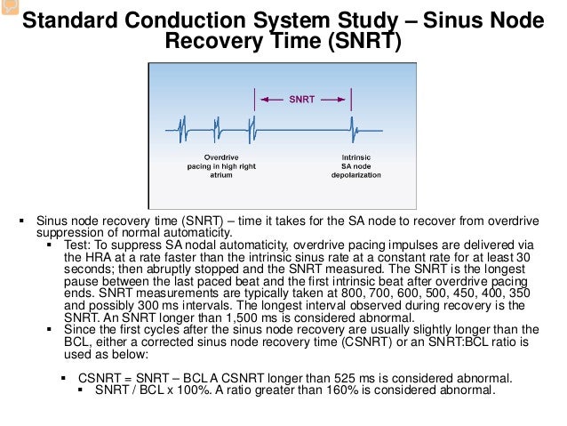 Electrophysiologic Study