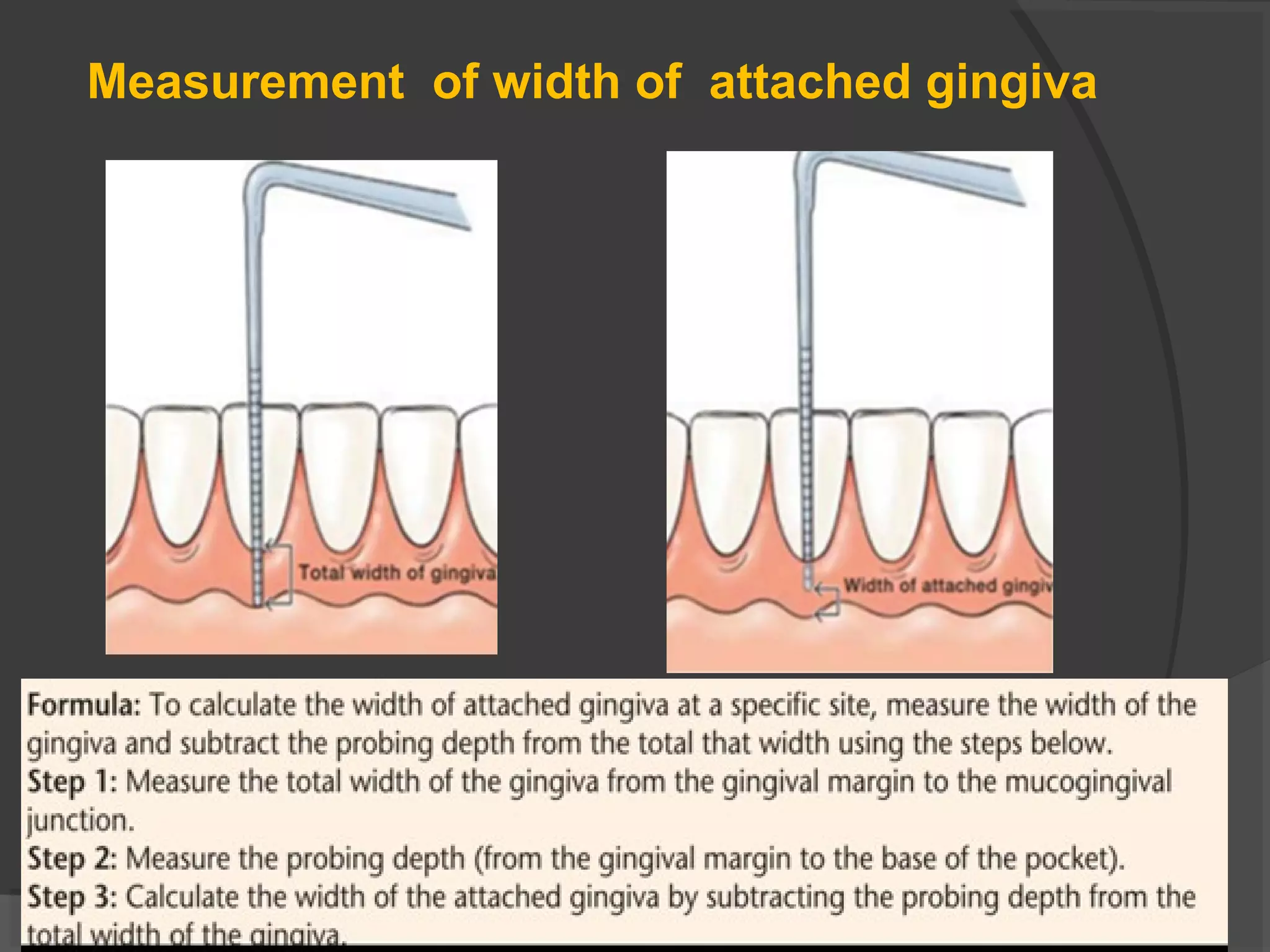 Periodontal examination and diagnosis | PPT