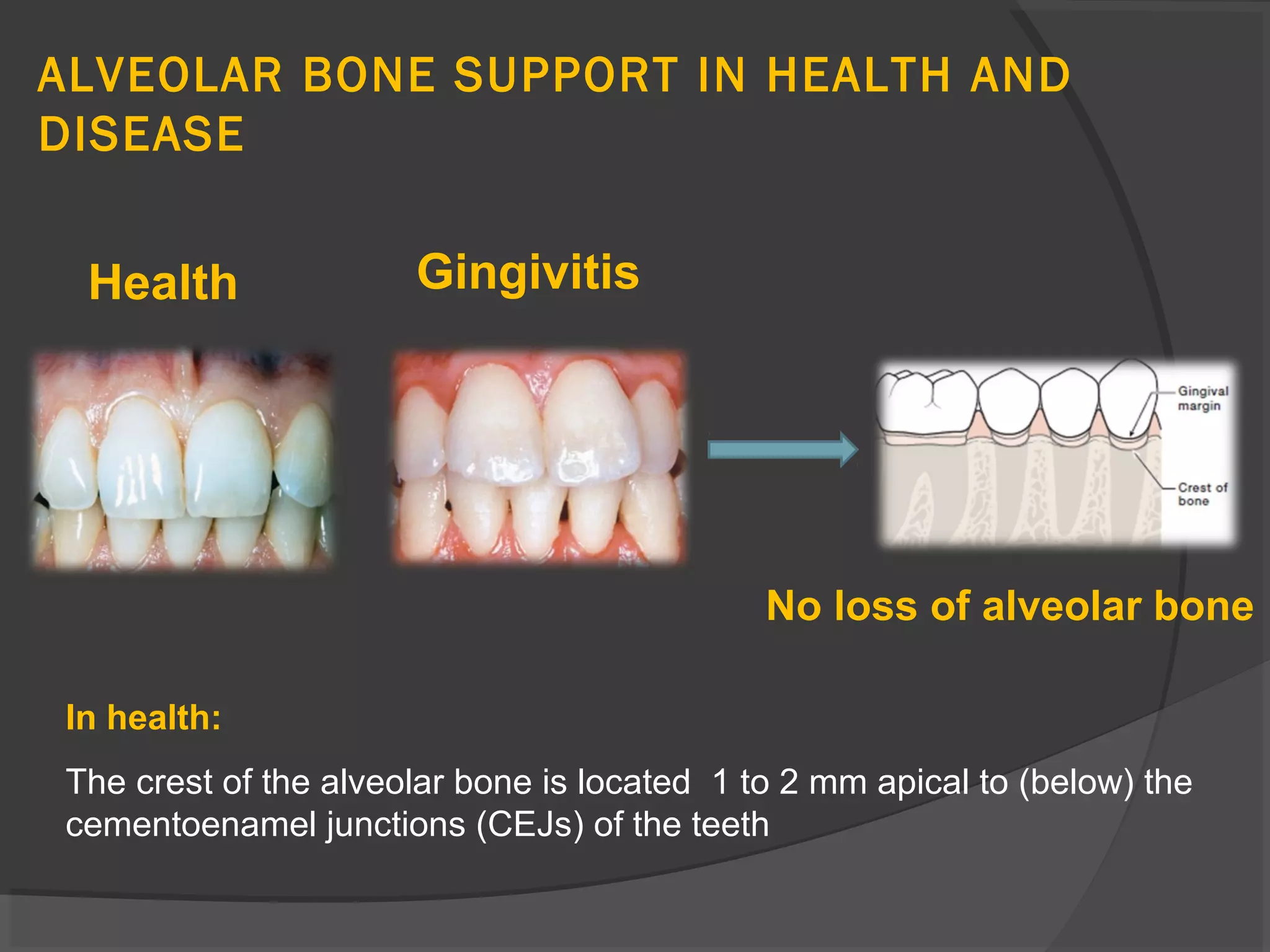 Periodontal examination and diagnosis | PPT