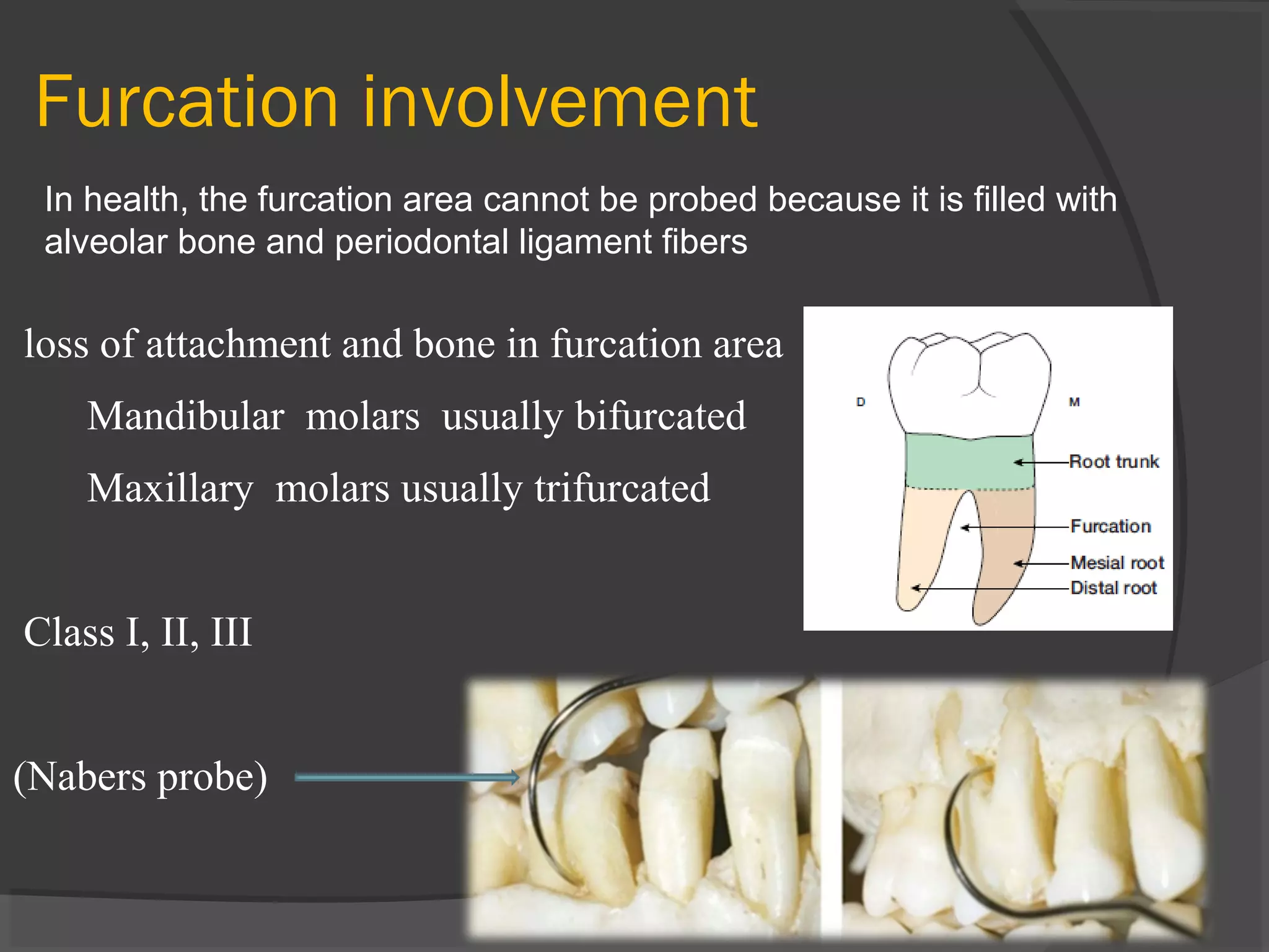 Periodontal examination and diagnosis | PPT