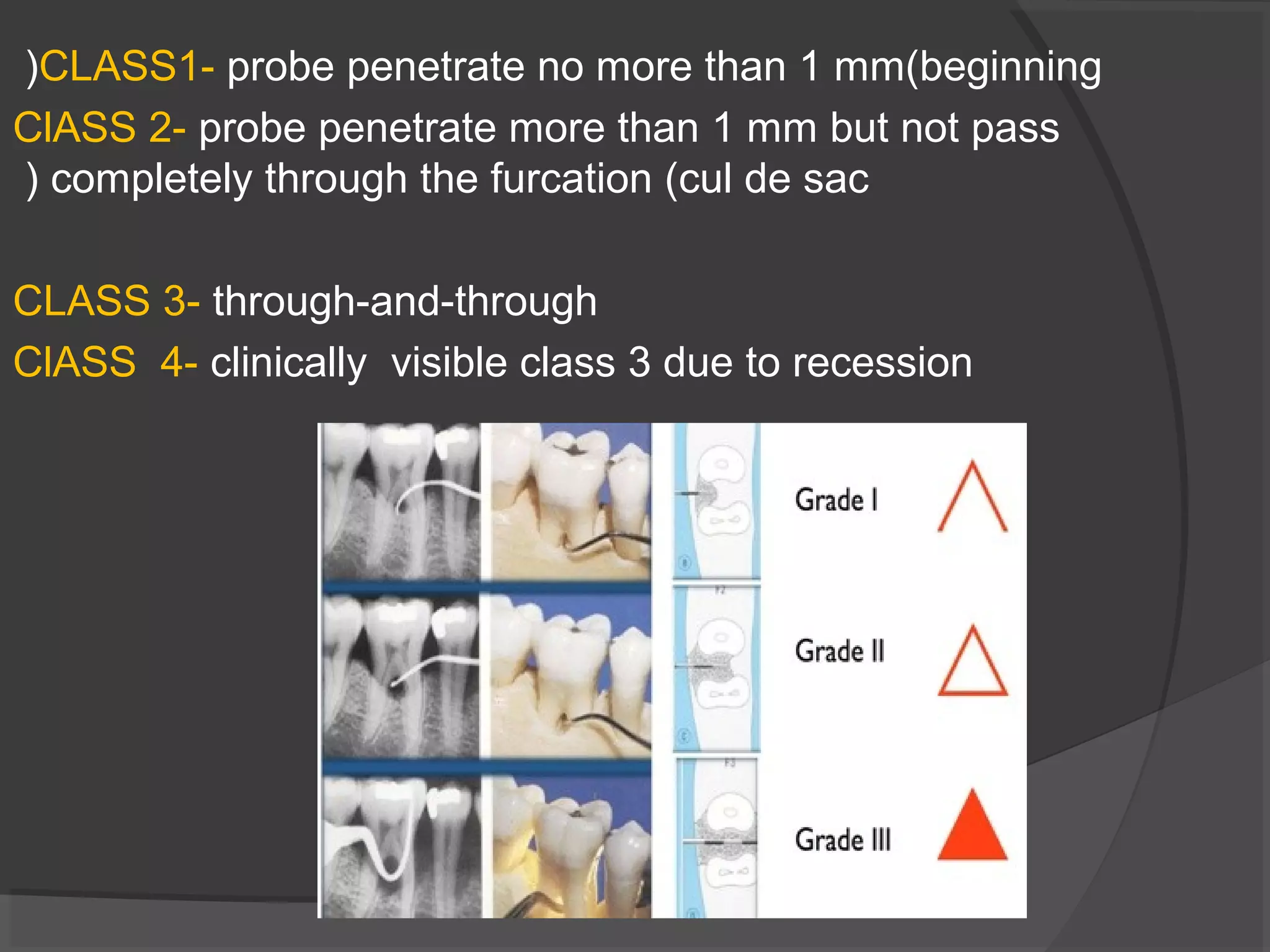 Periodontal examination and diagnosis | PPT